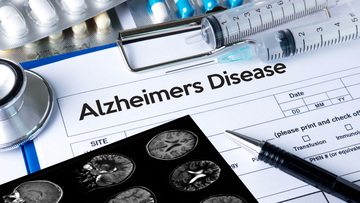 Atrium Health’s Response to New FDA-Approved Alzheimer’s Drug